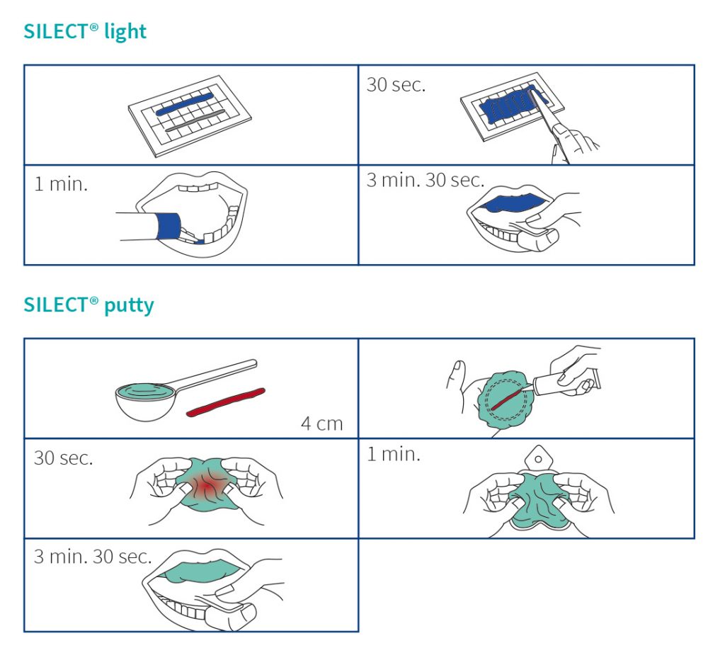 SILECT® – Müller-Omicron GmbH & Co. KG