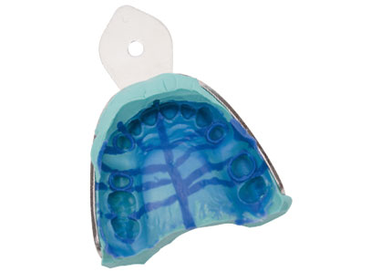 Impression materials – Müller-Omicron GmbH & Co. KG