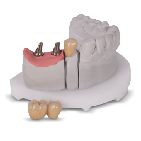 gingiva MASK, gingiva MASK 3D, gingiva MASK SEP – Müller-Omicron GmbH ...